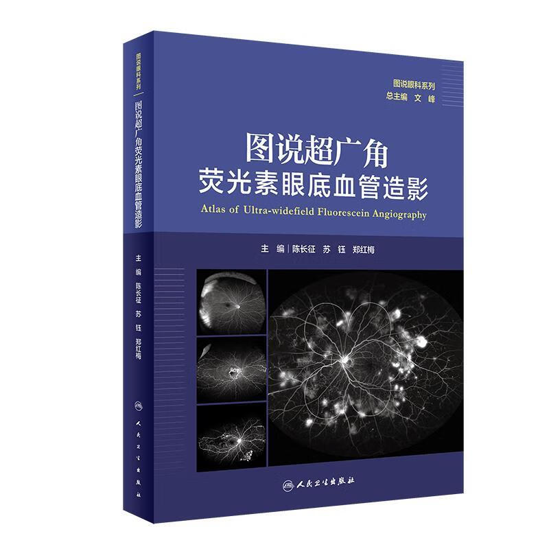 图说超广角荧光素眼底血管造影 9787117314510