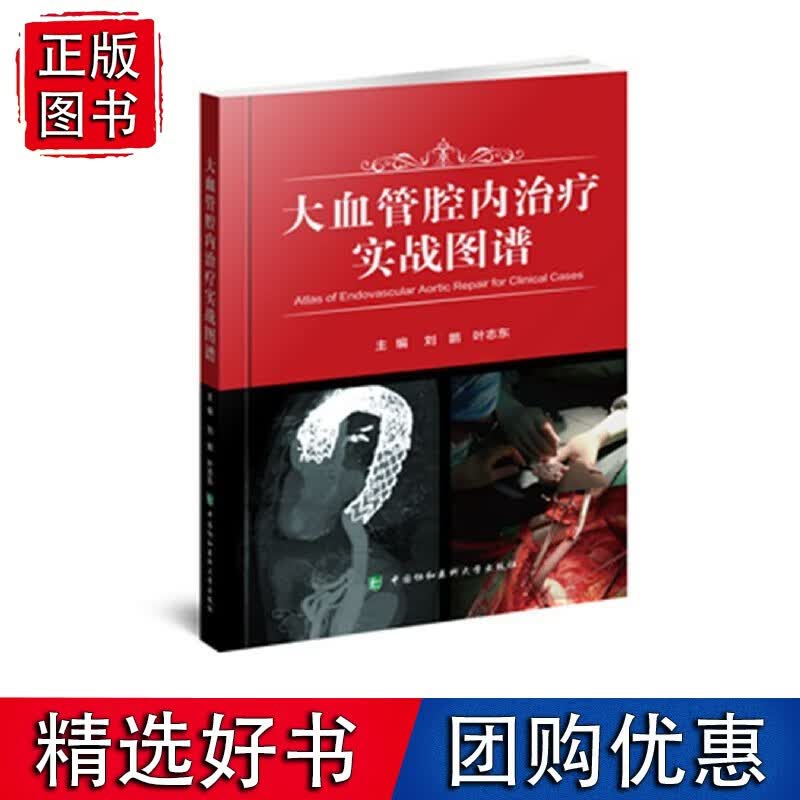 大血管腔内治疗实战图谱