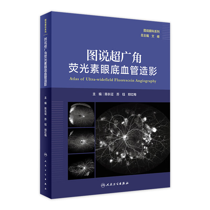 图说超广角荧光素眼底血管造影（图说眼科系列）