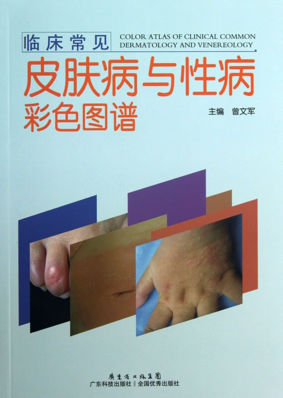 临床常见皮肤病与性病彩色图谱