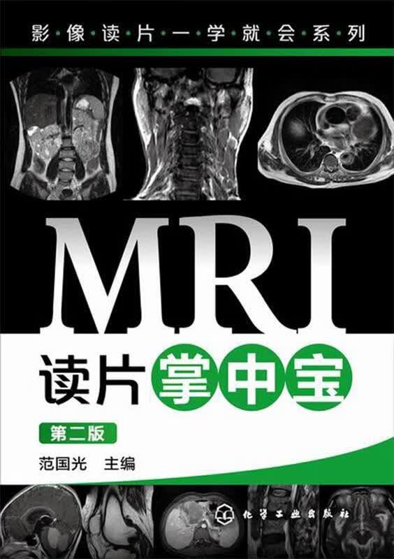MRI读片掌中宝