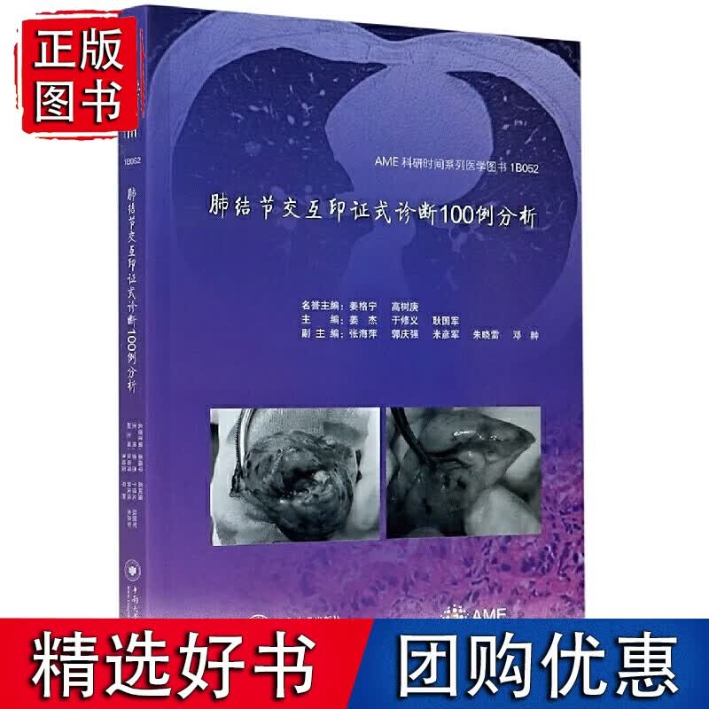 肺结节交互印证式诊断100例分析