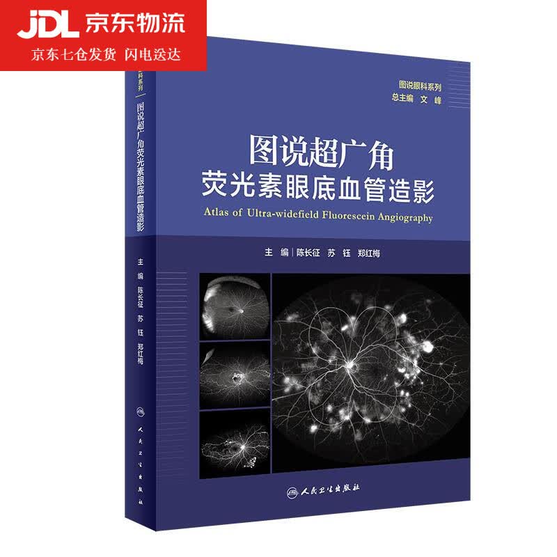 图说超广角荧光素眼底血管造影 9787117314510