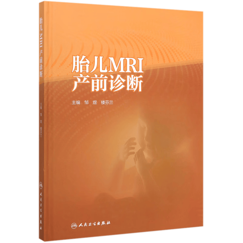 胎儿MRI产前诊断(精)