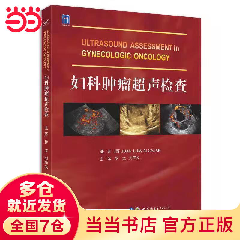 妇科肿瘤超声检查