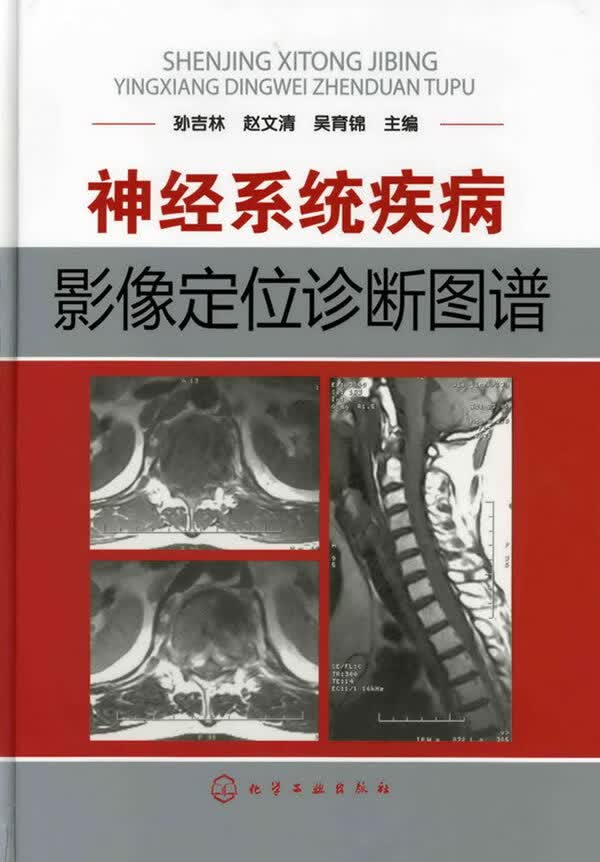 神经系统疾病影像定位诊断图谱