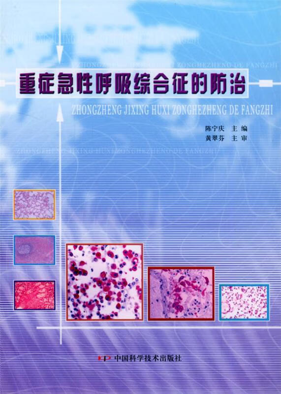 重症急性呼吸综合征的防治 陈宁庆 中国科学技术出版社