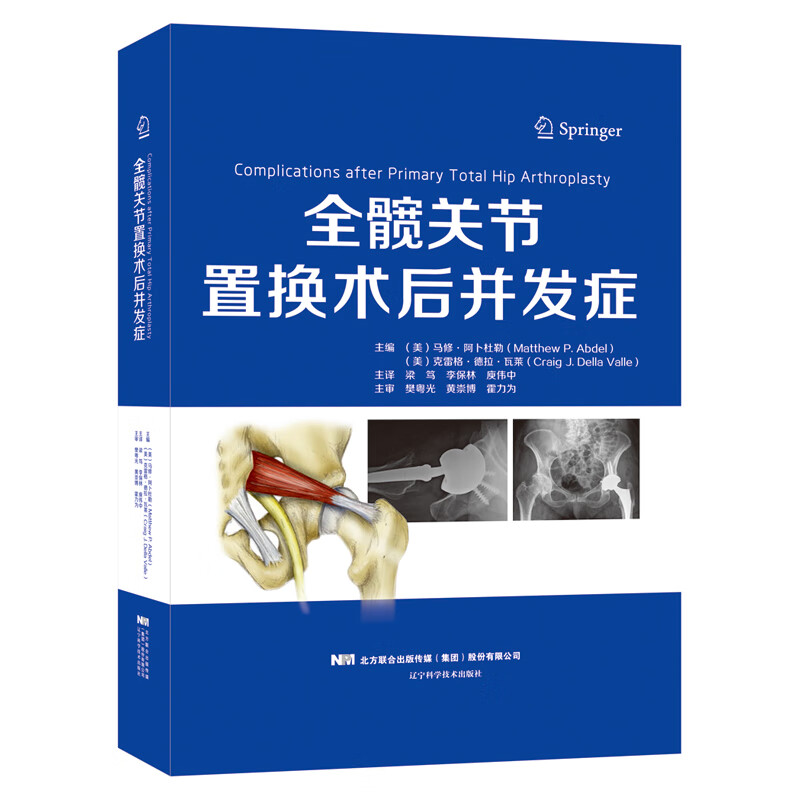 全膝关节置换术：综述与指南