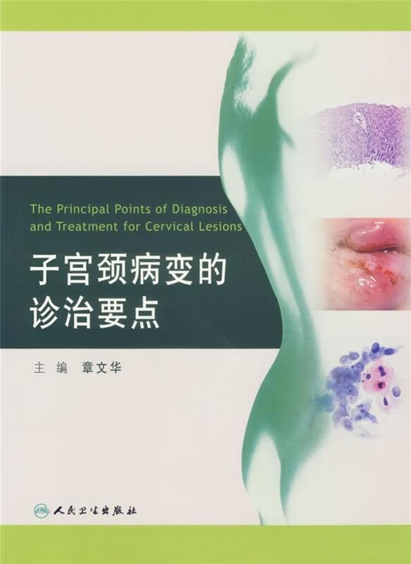 子宫颈病变的诊治要点