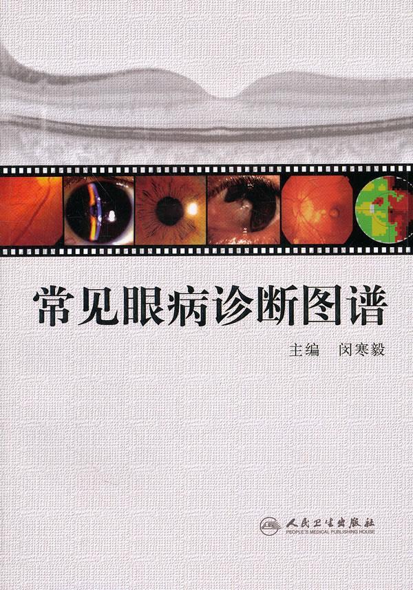 常见眼病诊断图谱