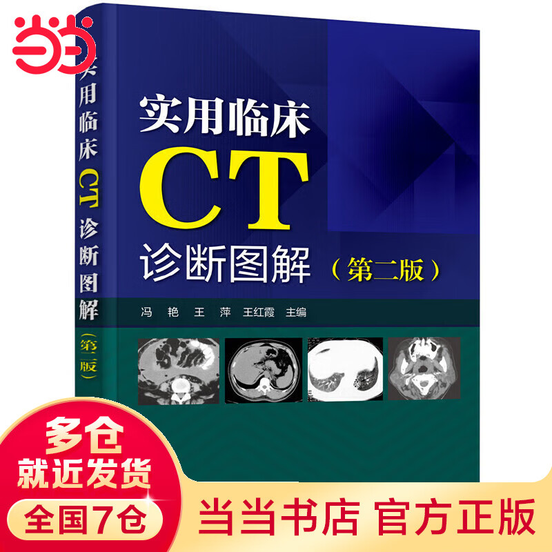 实用临床CT诊断图解（第二版）