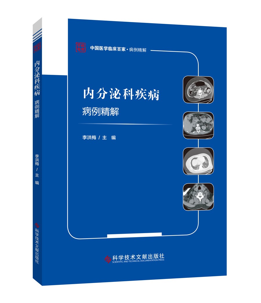 内分泌科疾病病例精解