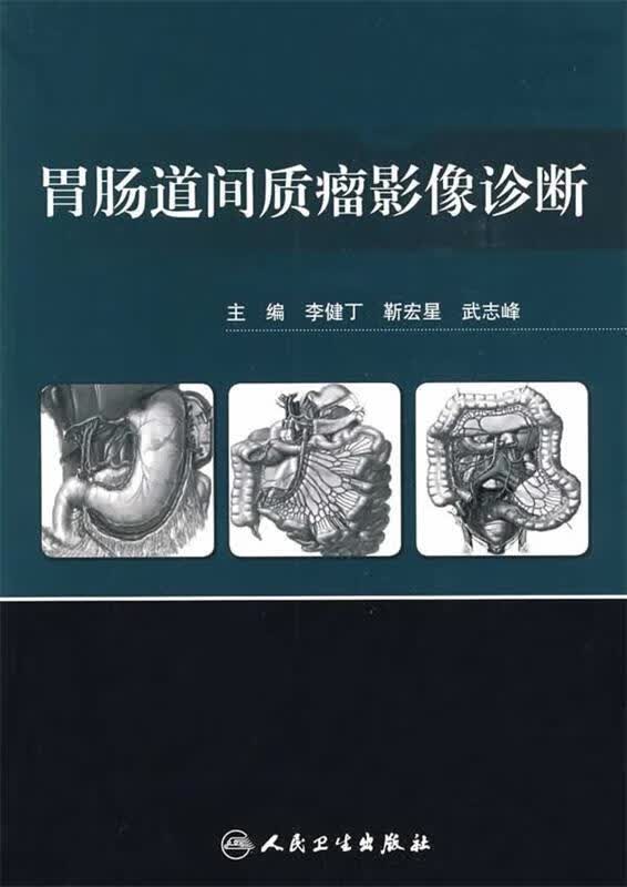 胃肠道间质瘤影像诊断