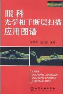 眼科光学相干断层扫描应用图谱