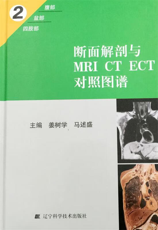 断面解剖与MRI CT ECT对照图谱2 姜树学,马述盛 主编【书】
