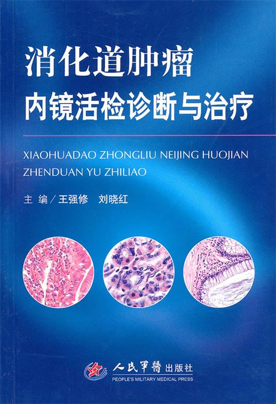 消化道肿瘤内镜活检诊断与治疗
