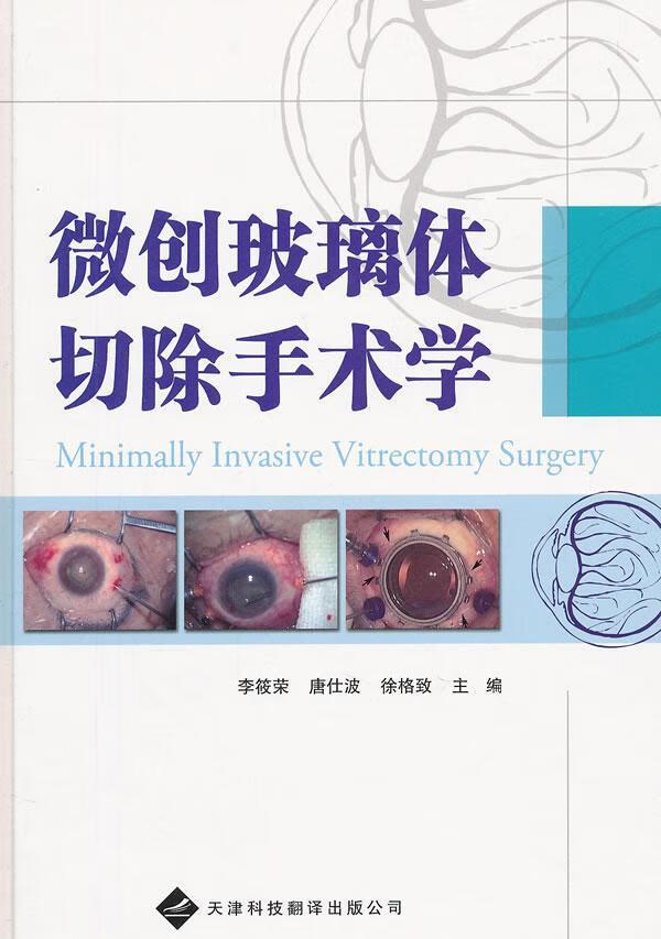 微创玻璃体切除手术学李筱荣医学9787543330382