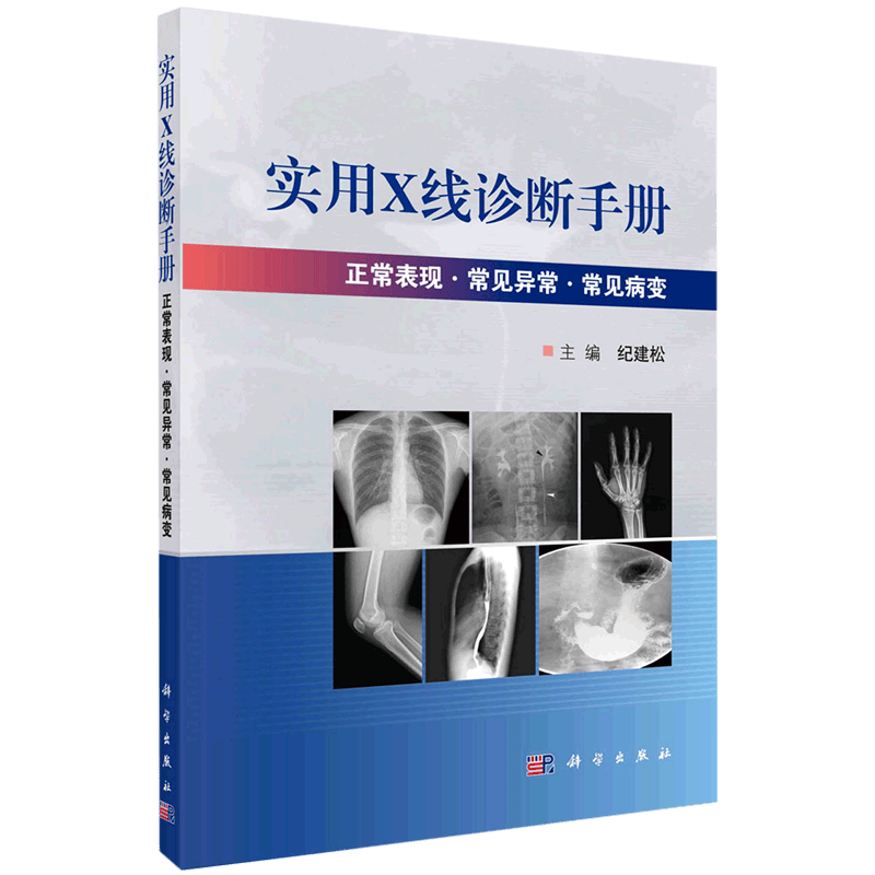 实用X线诊断手册(正常表现常见异常常见病变)