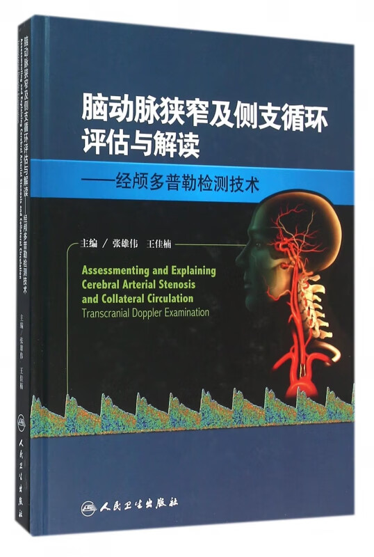 脑动脉狭窄及侧支循环评估与解读--经颅多普勒检测技术(精)