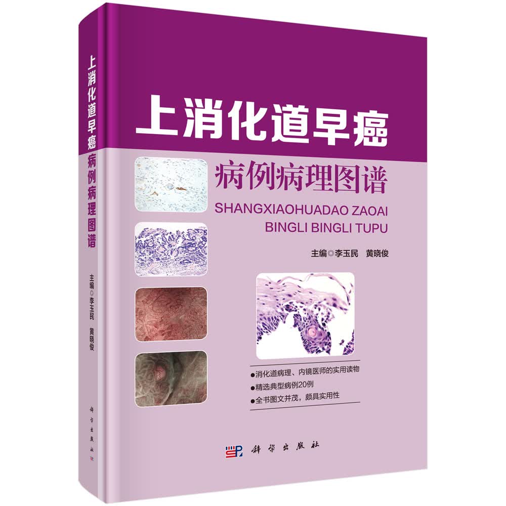 上消化道早癌病例病理图谱