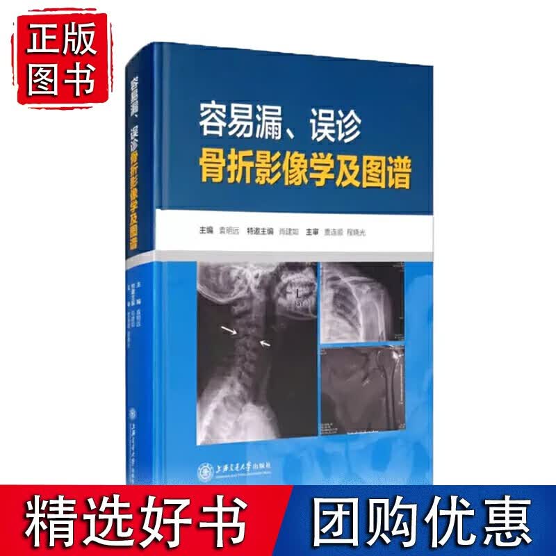 容易漏、误诊骨折影像学及图谱
