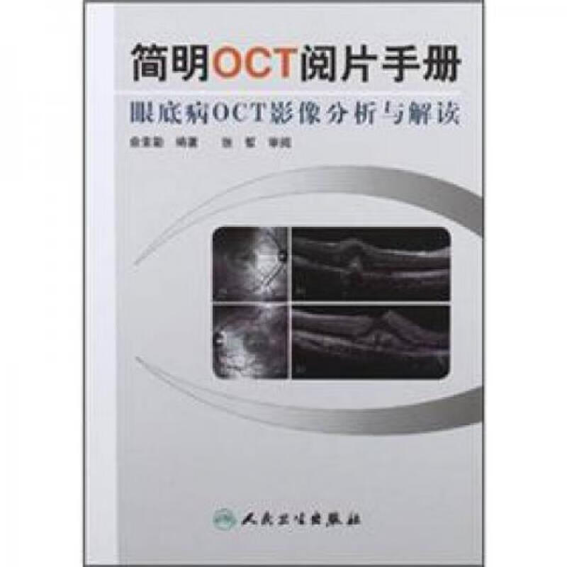 简明OCT阅片手册：眼底病OCT影像分析与解读