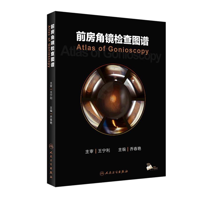 前房角镜检查图谱(精)