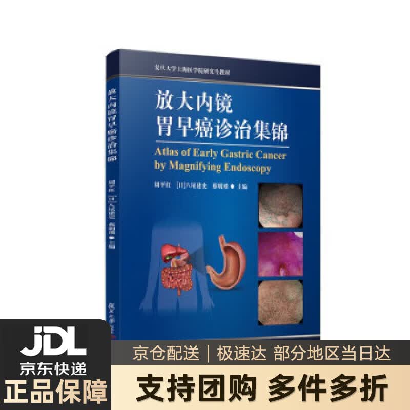 【 送货上门】放大内镜胃早癌诊治集锦