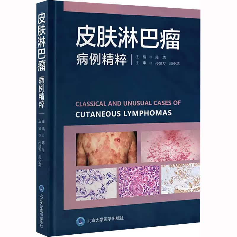 皮肤淋巴瘤病例精粹 图书