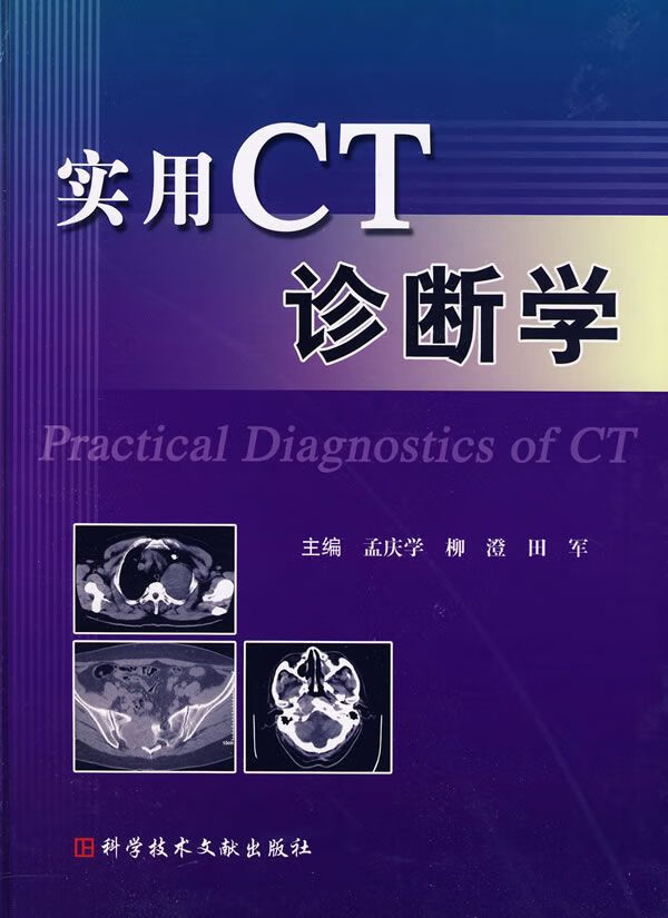 实用CT诊断学