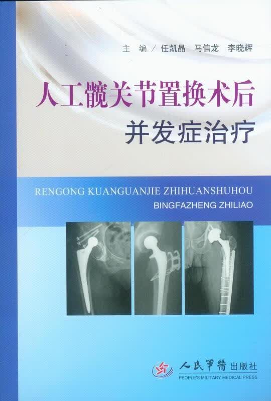 人工髋关节置换术后并发症治疗