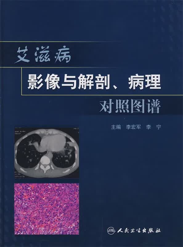 艾滋病 影像与解剖、病理对照图谱：D6书架
