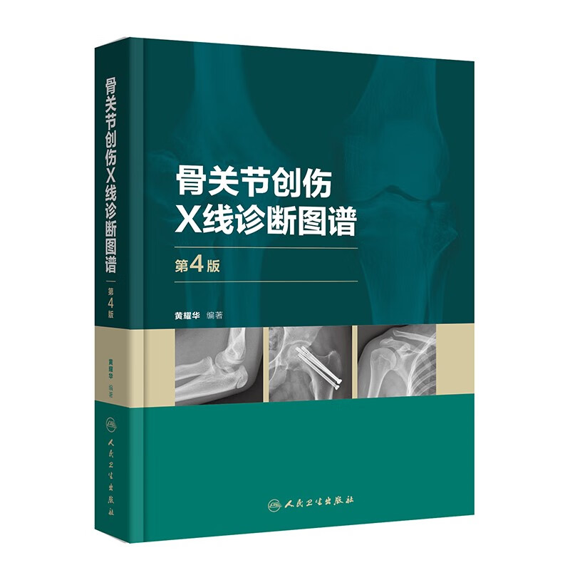 骨关节创伤X线诊断图谱（第4版）