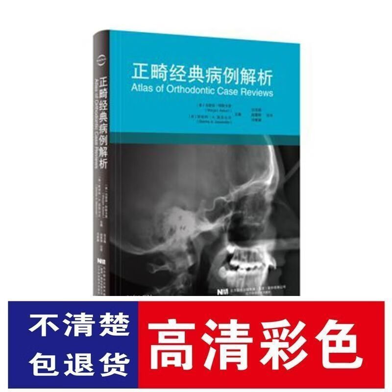 高清彩色 正畸病例解析