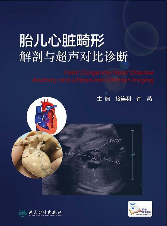 胎儿心脏畸形解剖与超声对比诊断(配增值)
