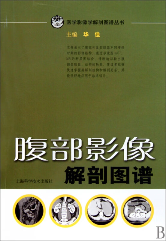 腹部影像解剖图谱/医学影像学解剖图谱丛书