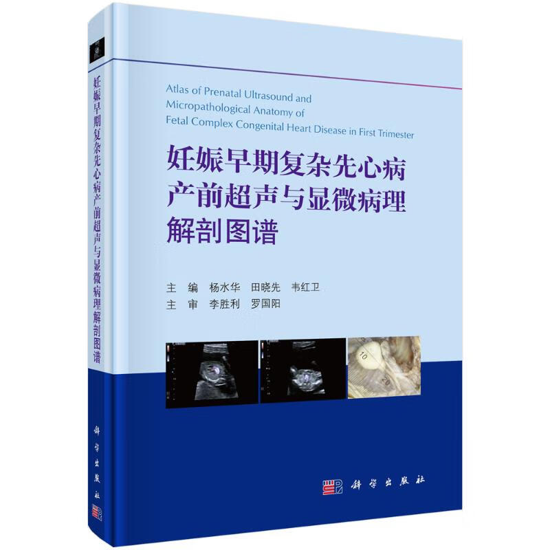 妊娠早期复杂先心病产前超声与显微病理解剖图谱(精)