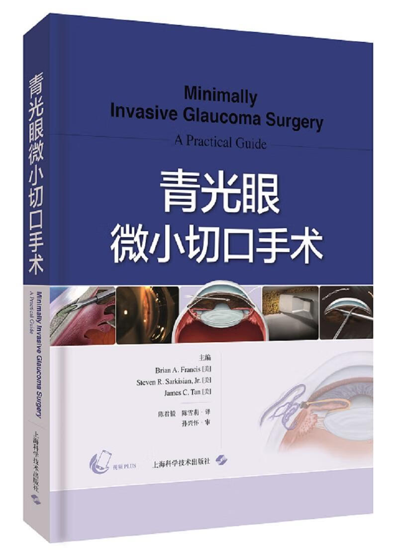 青光眼微小切口手术/上海科学技术出版社/医学/书籍