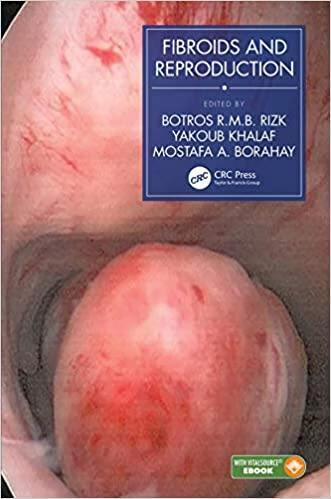 Fibroids and Reproduction