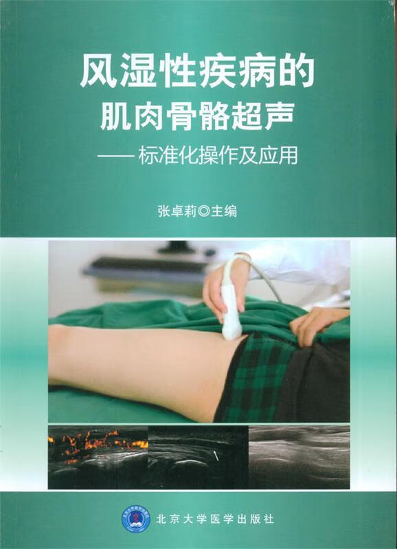 风湿性疾病的肌肉骨骼超声-标准化操作及应用