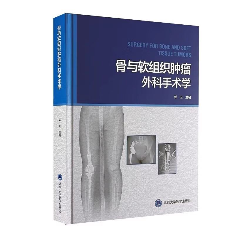 骨与软组织肿瘤外科手术学 郭卫 良性骨肿瘤的外科治疗恶性骨肿瘤的保肢治疗儿童恶性骨肿瘤的保肢治疗等 北京大学医学出版社