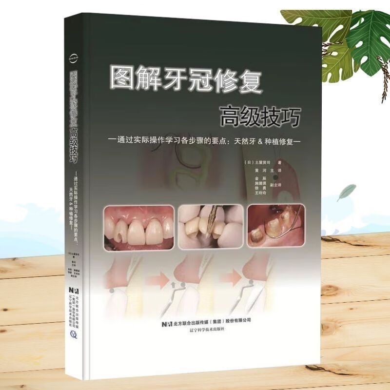 图解牙冠修复高级技巧/土屋贤司