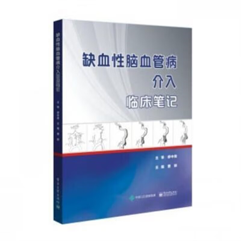 缺血性脑血管病介入临床笔记 曹骅 缺血性脑血管病介入临床笔记 入临床笔记