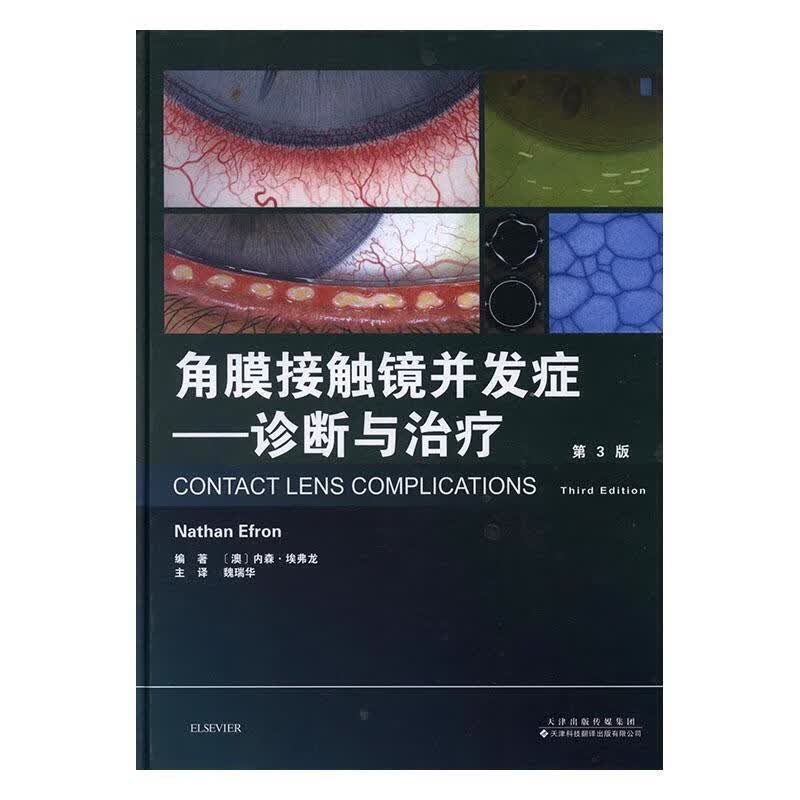 RT 角膜接触镜并发症：诊断与 9787543336117 天津科技翻译出版有限公司 医学