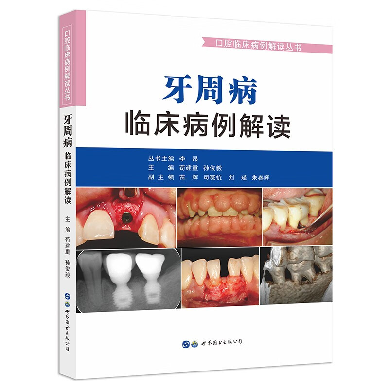牙周病临床病例解读