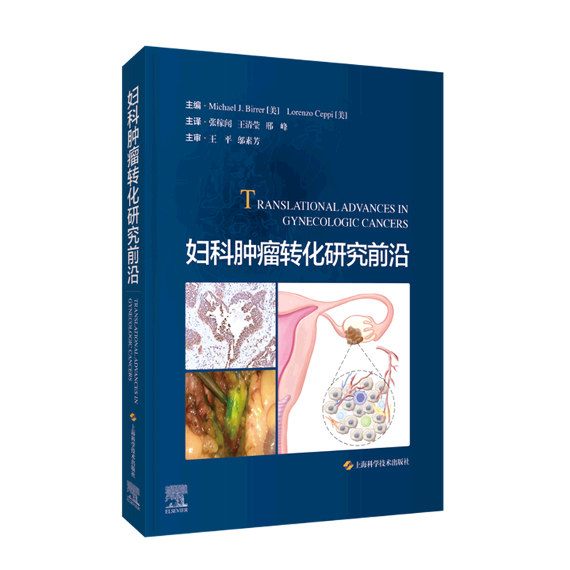 妇科肿瘤转化研究前沿(精)