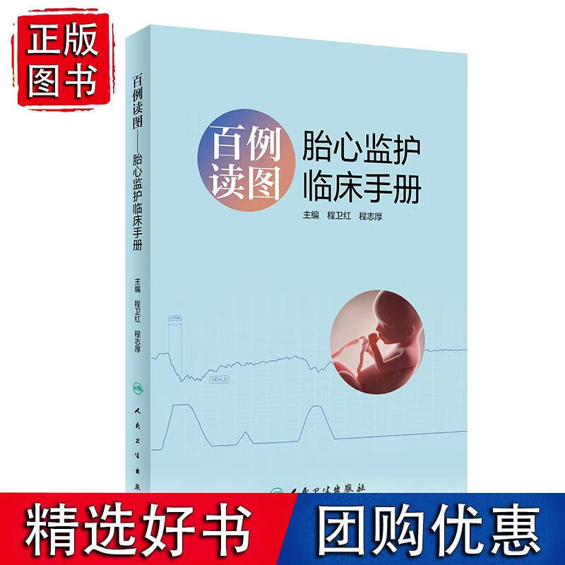 百例读图·胎心监护临床手册