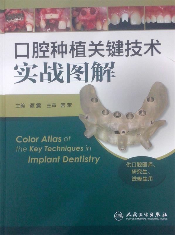 口腔种植关键技术实战图解