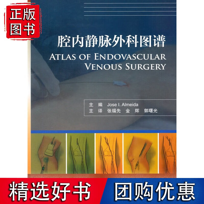 腔内静脉外科图谱(翻译版)