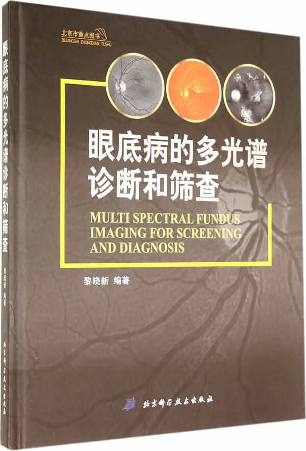 眼底病的多光谱诊断和筛查精